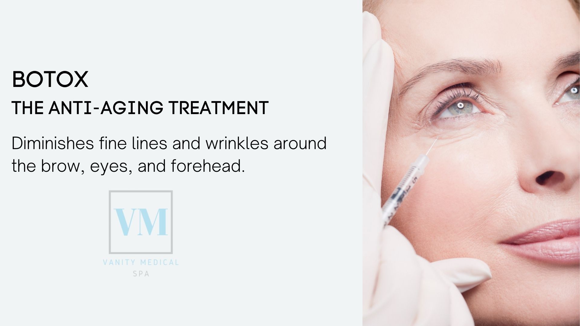 Your Botox Questions Answered | Vanity Medical Spa