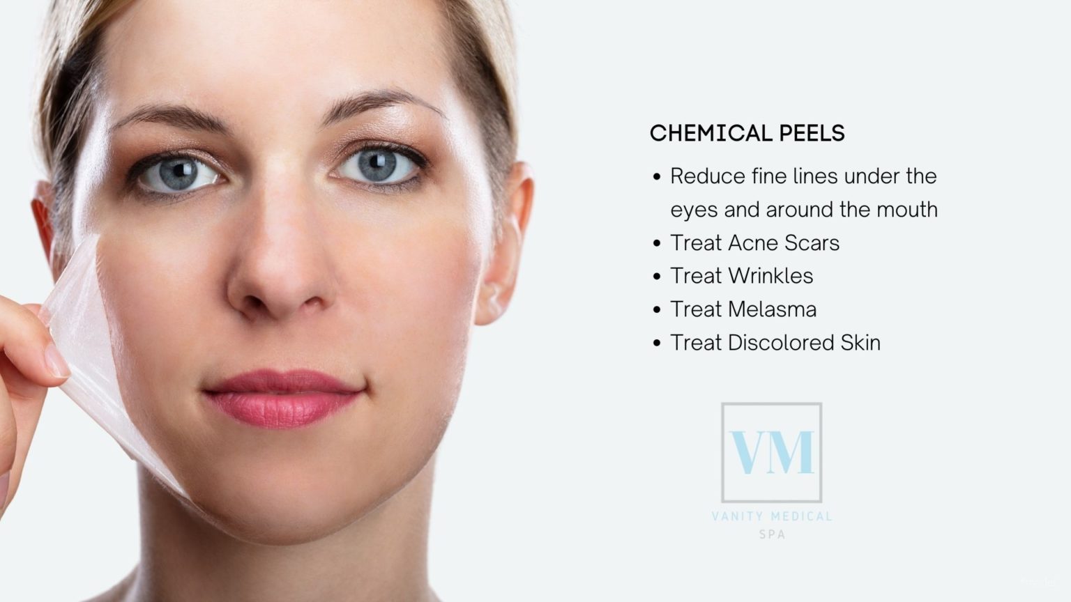 Chemical Peels: Types, Risks, Conditions Treated, and More | Vanity ...