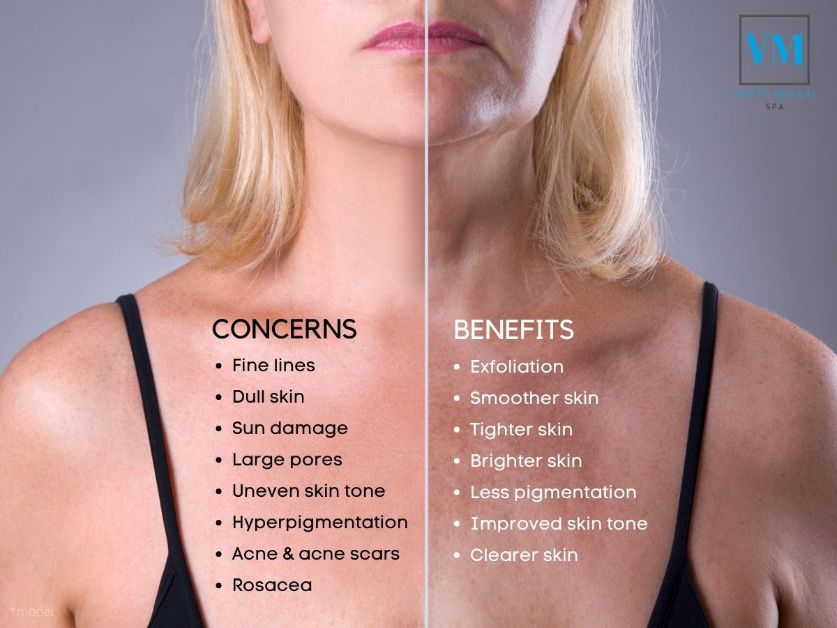 Breaking Down the Science of Skin Texture - Treatments and Options You ...