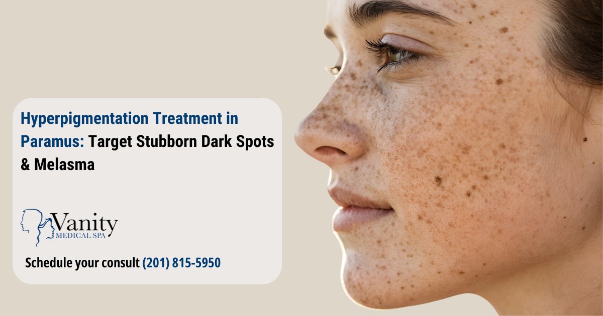 Target Stubborn Dark Spots & Melasma | Hyperpigmentation Treatment in ...