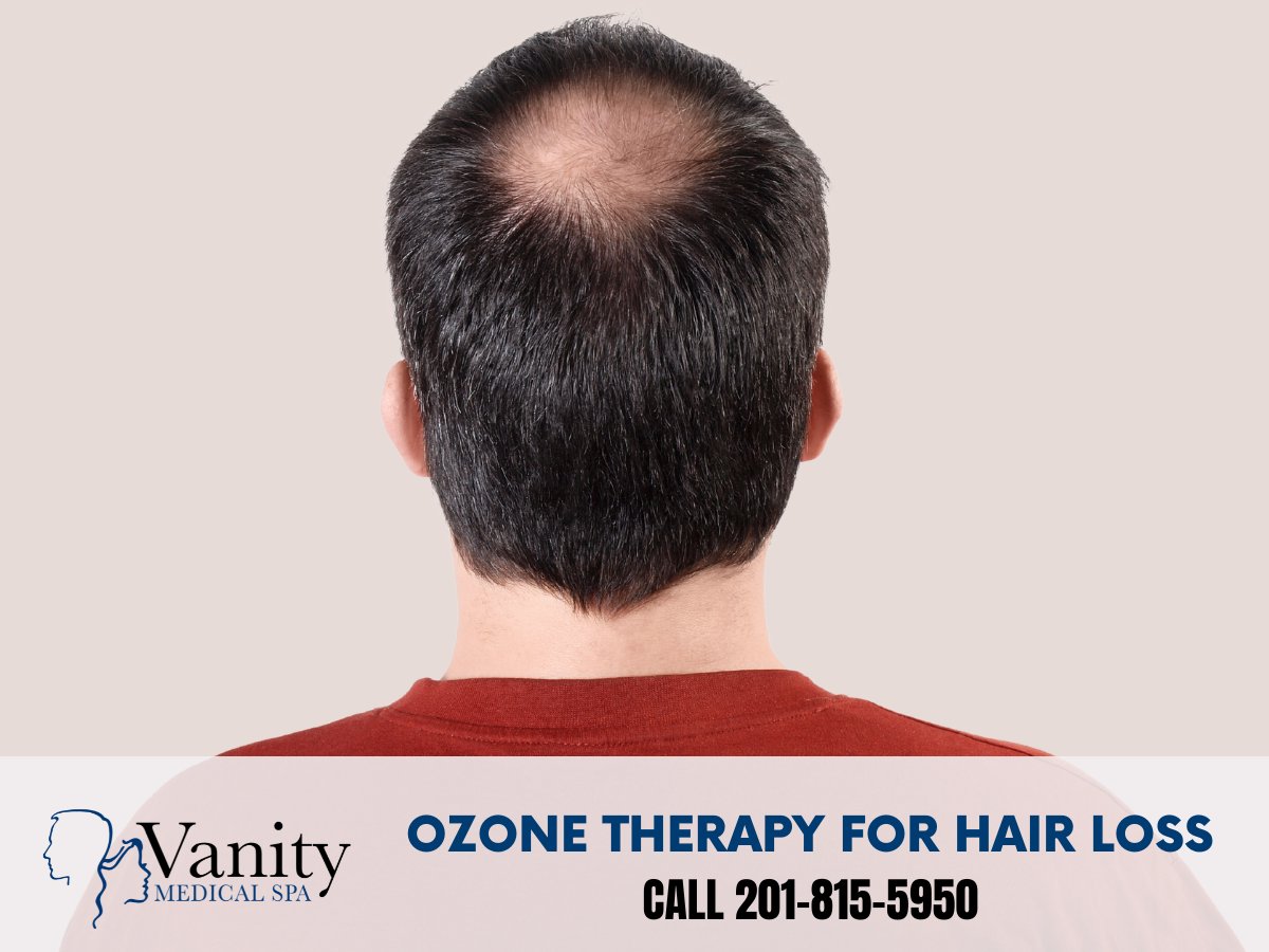 Ozone Therapy for Hair Loss in Paramus, NJ | Vanity Medical Spa