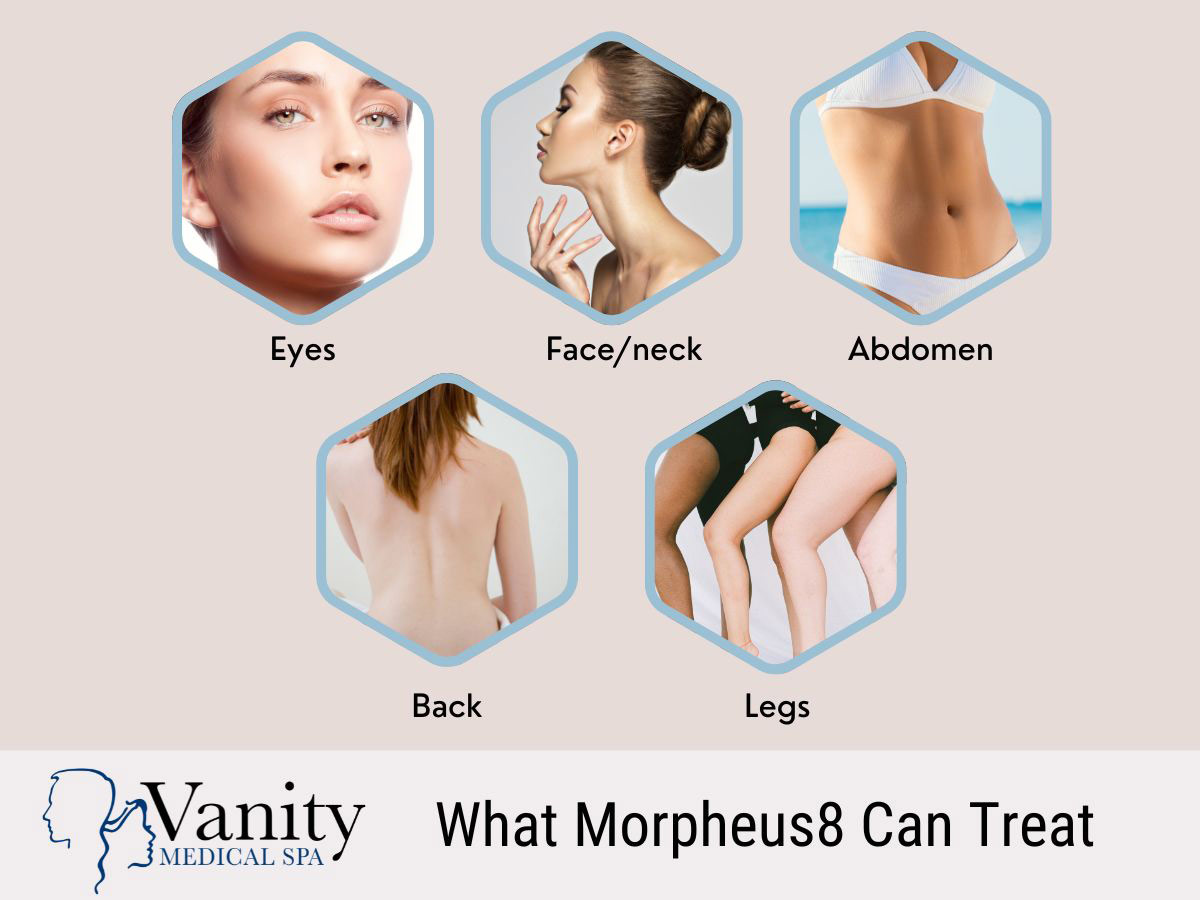 When is the Best Time for Morpheus8? Why Winter is Ideal | Vanity ...